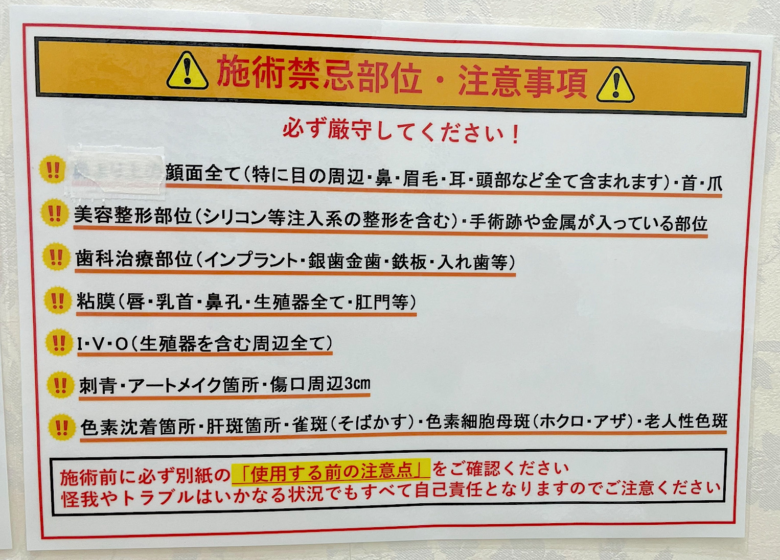 酷評多数！チョコザップの脱毛に行ってみた本音の口コミ評判 | SECOND EFFORT（セカンド エフォート